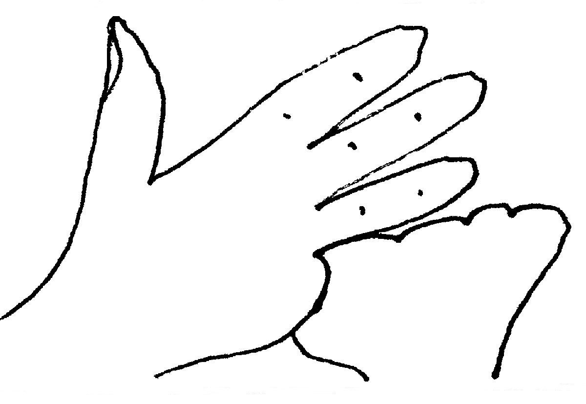 oedeem therapy